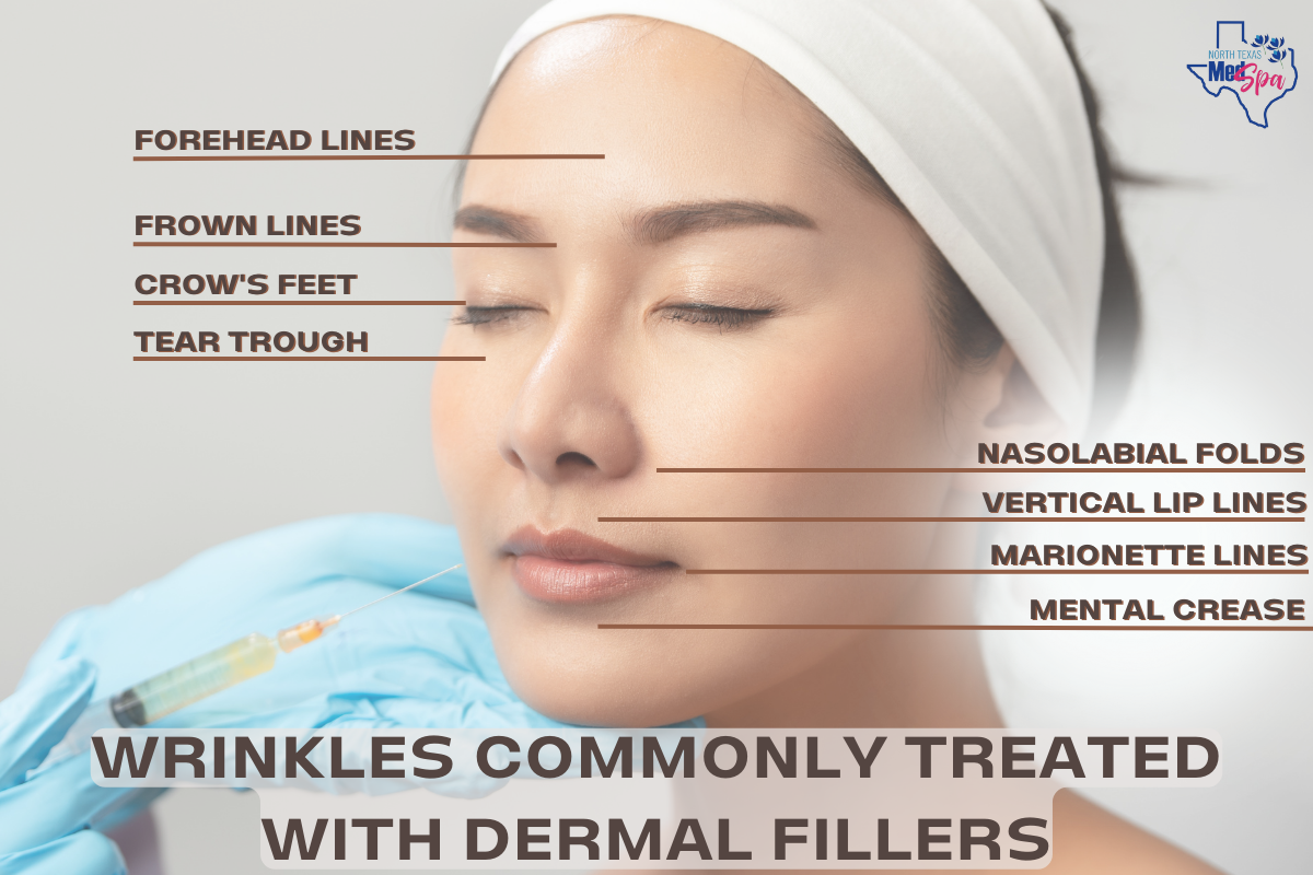 Exploring the Different Types of Dermal Fillers