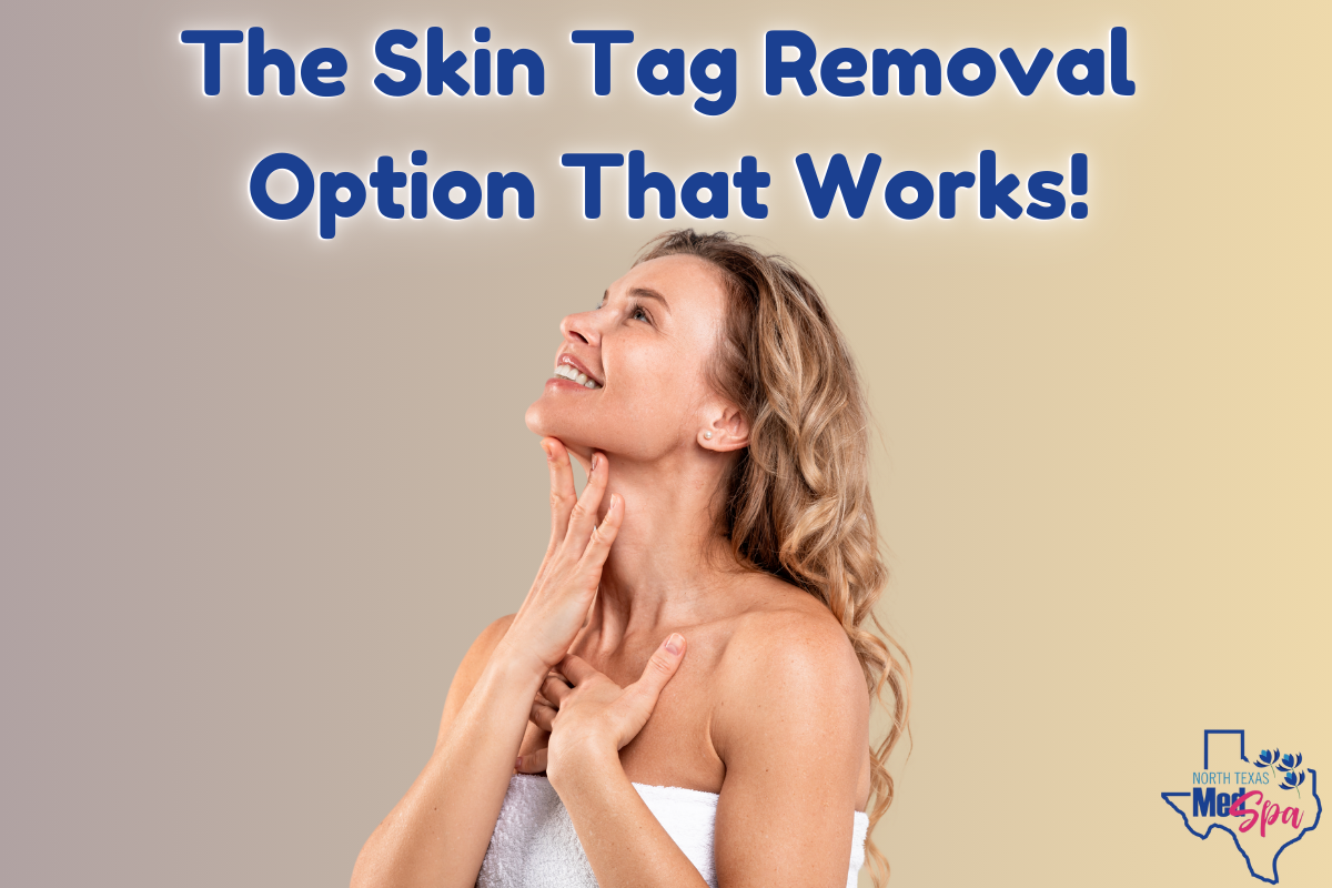 The Skin Tag Removal Option That Works - North Texas MedSpa